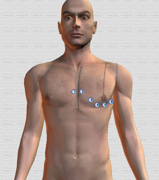 Quia - Electrocardiography