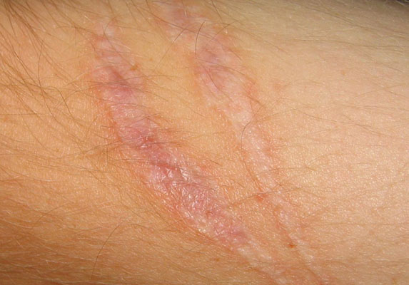 Quia - Descripciones - Imágenes