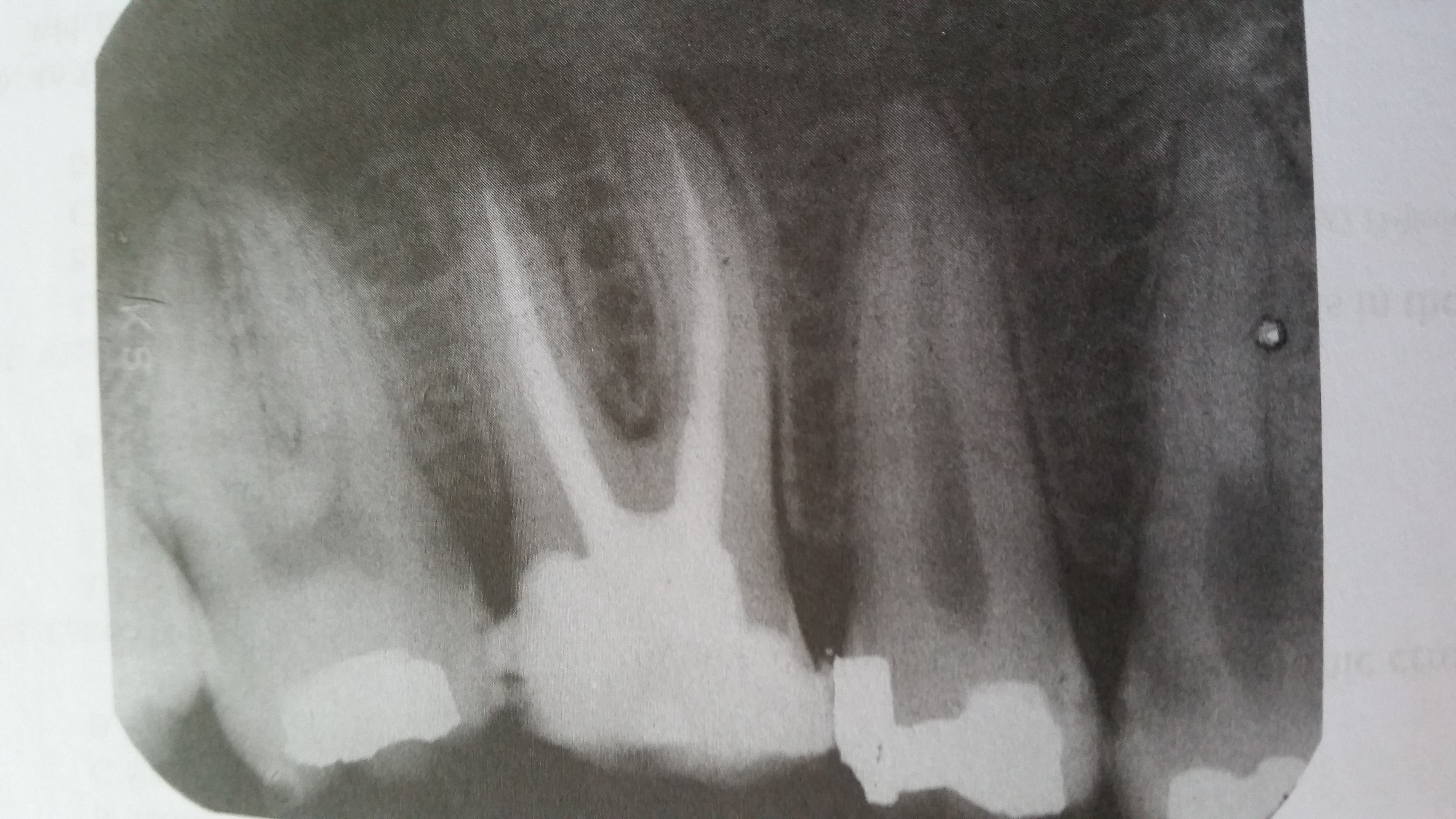 Quia - RADIOGRAPHY TSA