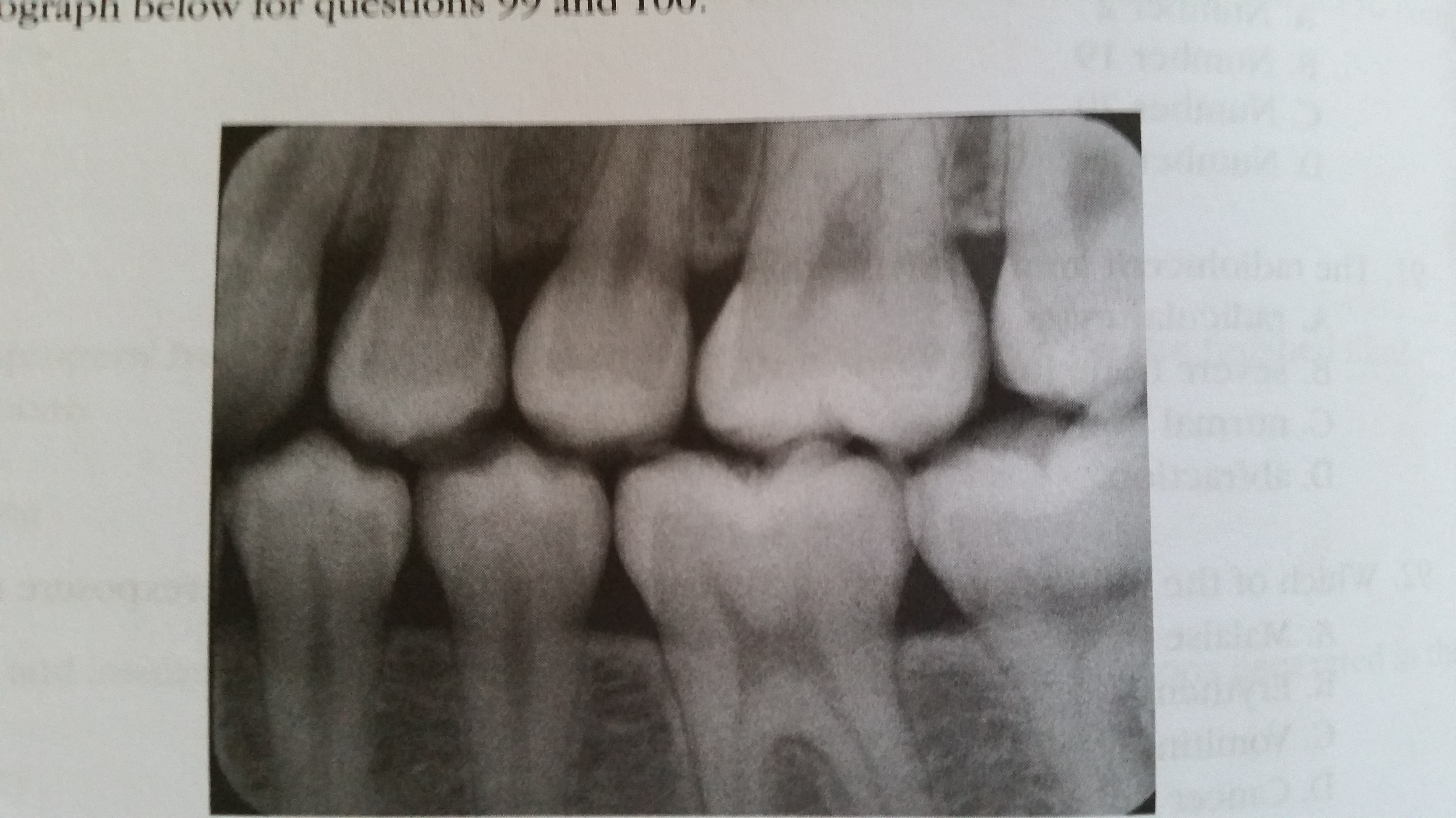 Quia - RADIOGRAPHY TSA