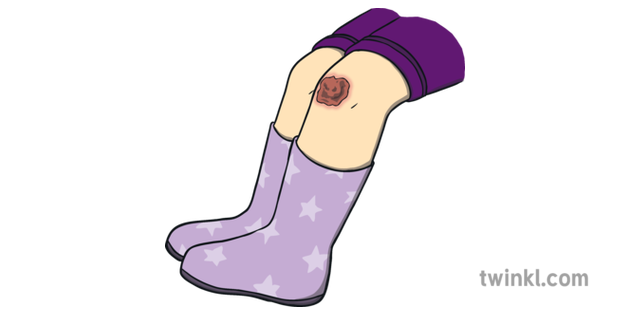 Quia - sk minimal pairs