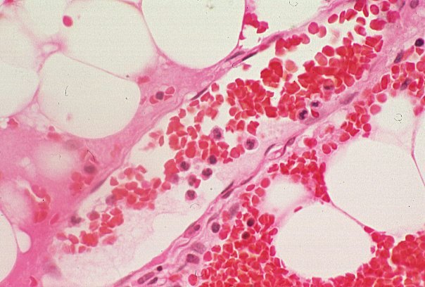 Blood Tissue Slide Labeled