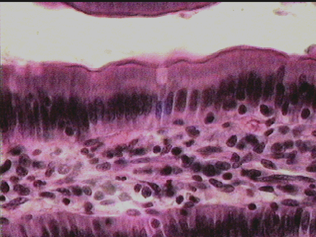 Epithelial Cells