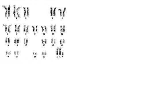 Quia - Genetics Disorders Matching
