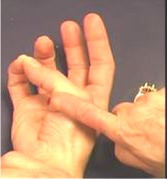 Quia - Extrinsics & Thenar Eminence Muscles