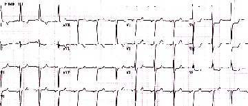 Quia - cardiology 002
