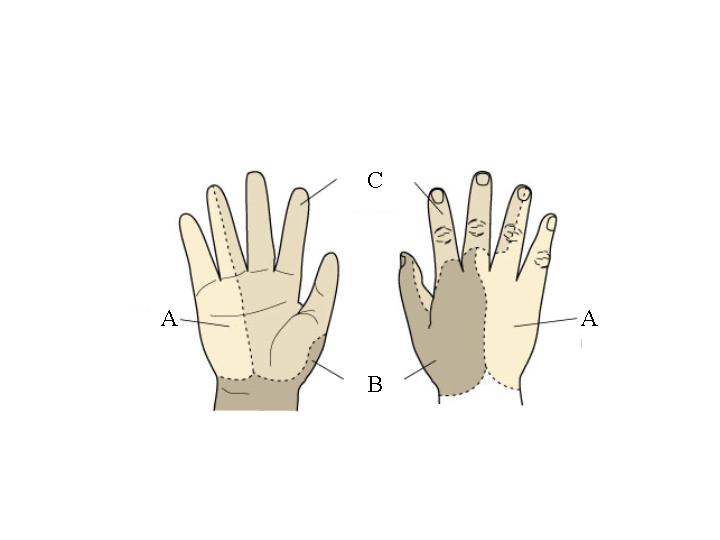 Quia - ortho-hand