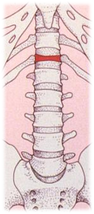 Quia - Yazvac - Fractures